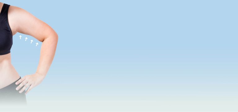 Arm Liposuction NYC - Arm Fat Removal Clinic | Alinea Lipo