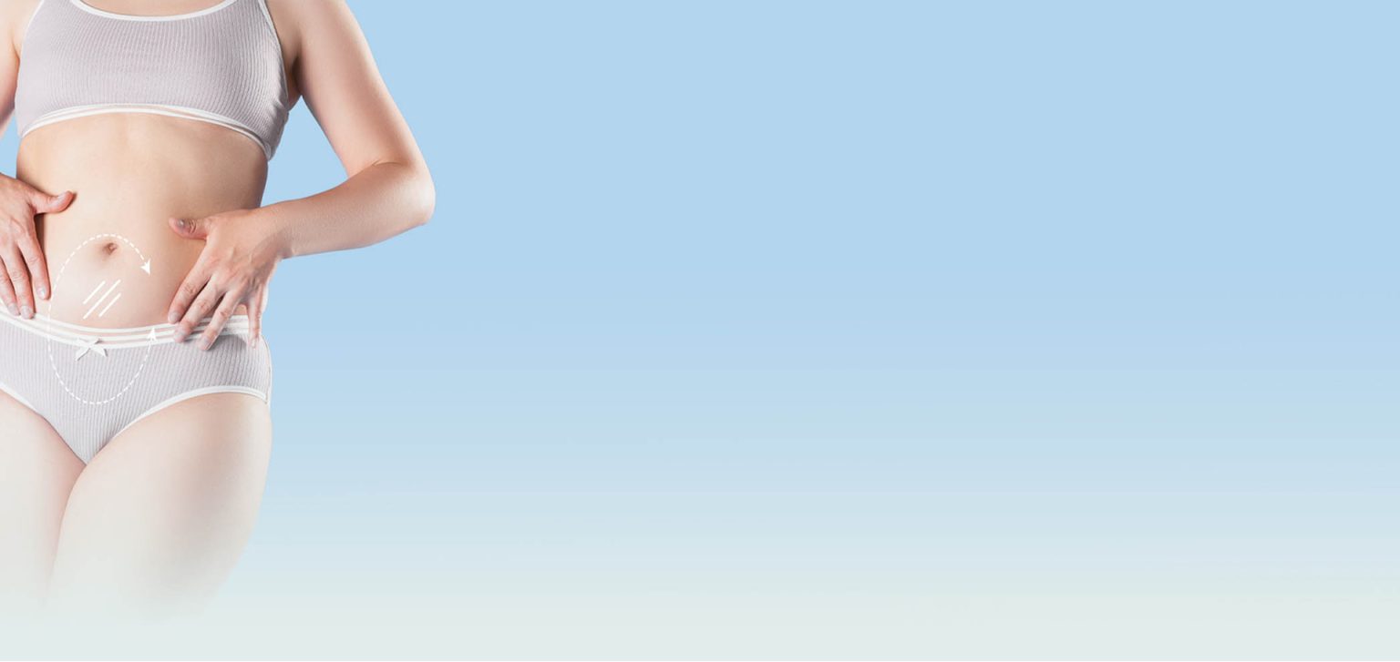 Mons Pubis Liposuction NYC - Mons Pubis Reduction | Alinea Lipo